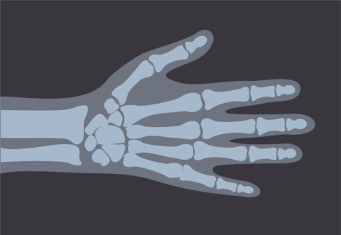 The ABCs Of PHI—Plus: Protected Health Information Decision Tree