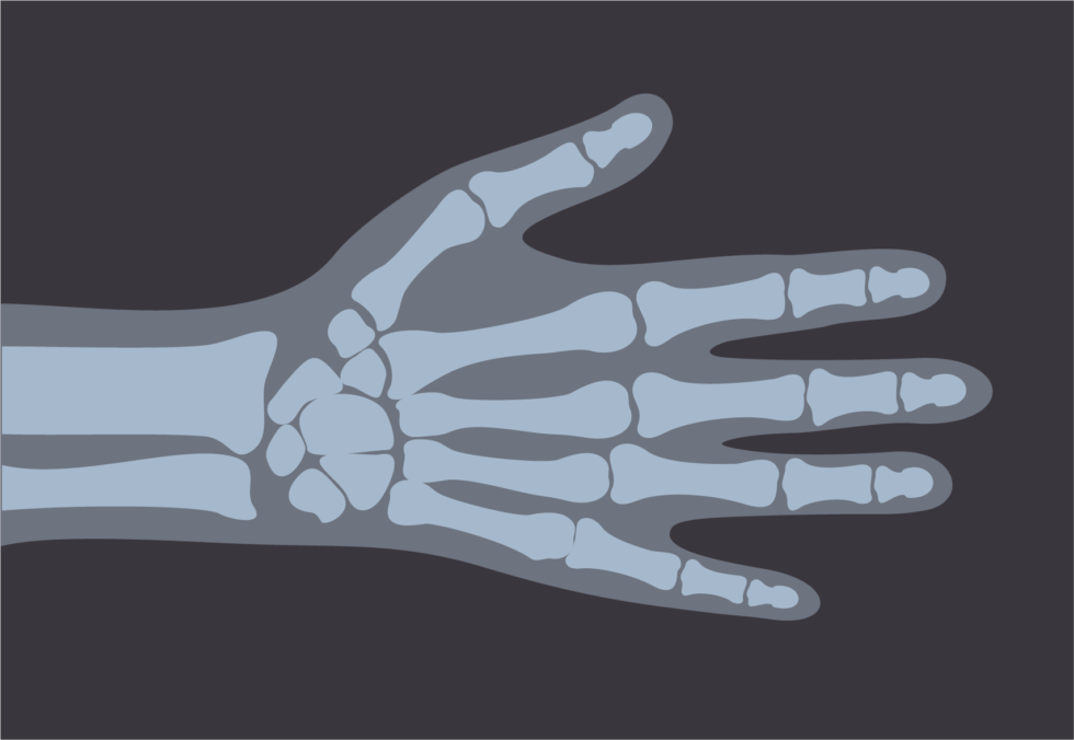 The ABCs Of PHI—Plus: Protected Health Information Decision Tree